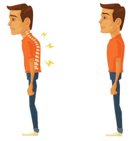 Wake Up This “Hidden” Muscle to Fix HUNCHBACK Posture (aka Kyphosis)