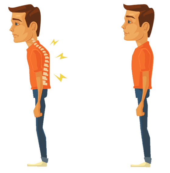 Wake Up This “Hidden” Muscle to Fix HUNCHBACK Posture (aka Kyphosis)