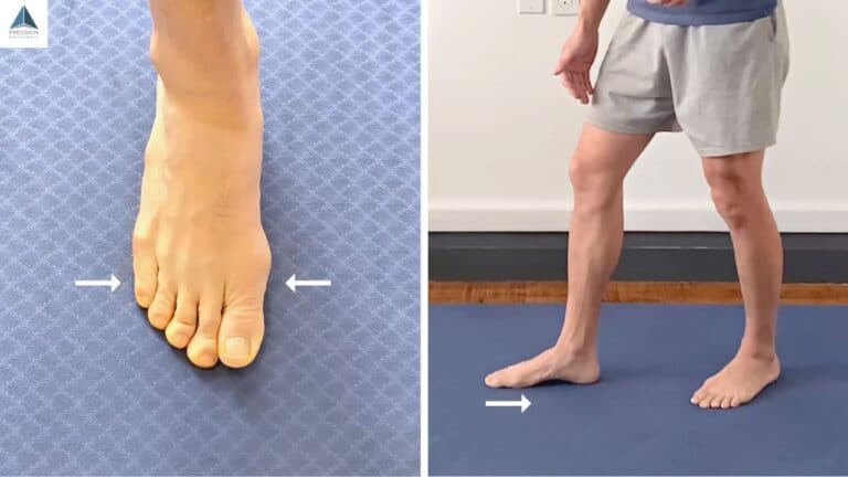 3 Two-Minute Knee Valgus Exercises to Fix the Root Cause - Precision ...