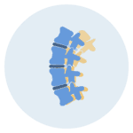 Low Back Pain Solution