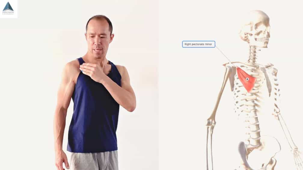 How to Fix Rounded Shoulders - 3 Easy Exercises