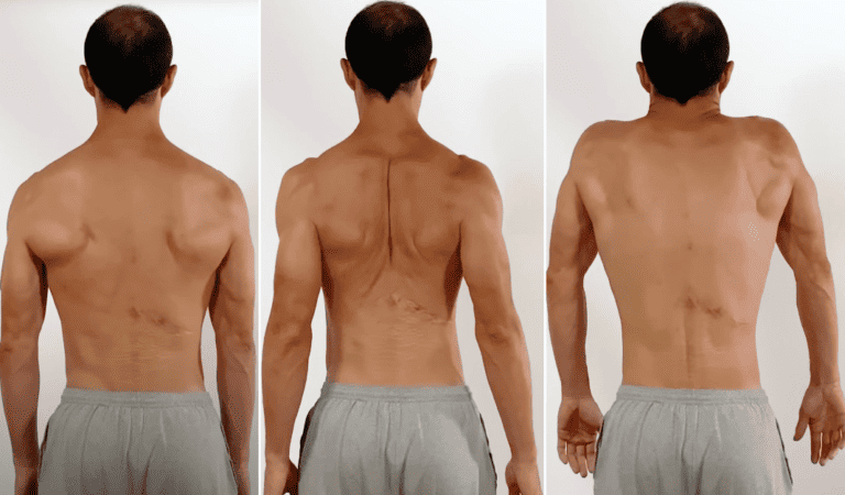 4 At-Home Exercises to Improve Shoulder Mobility (+ Progressions ...