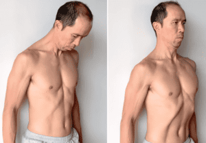The 5 Fundamental Movements to Prevent Shoulder Pain - Precision Movement